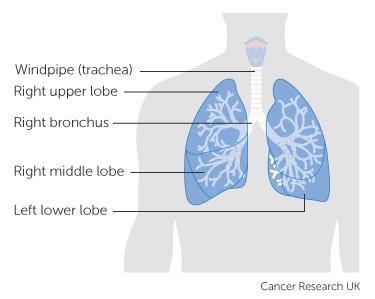 Diagram of the lungs and windpipe - Medcare SpainMedcare Spain