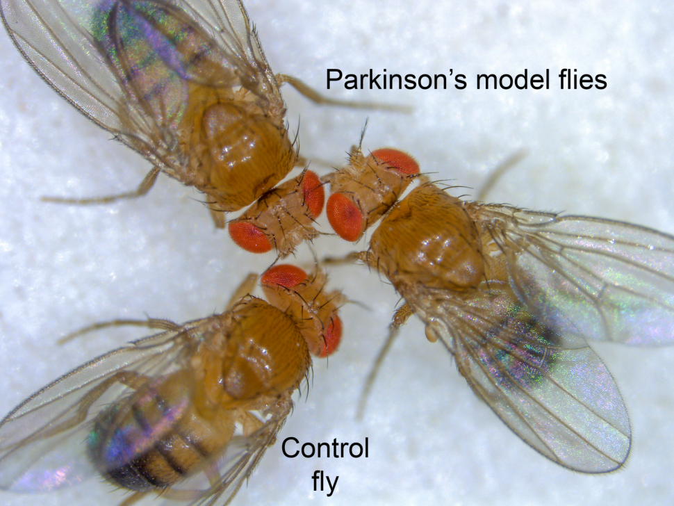 Parkinson's Disease - Medcare SpainMedcare Spain