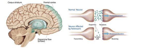 dopamine-chart - Medcare SpainMedcare Spain